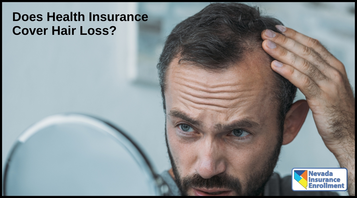 Does Health Insurance Cover Hair Loss? – Nevada Insurance Enrollment ...